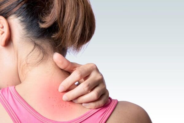 How Does HIV Affect Your Skin? - Z-ROC Dermatology